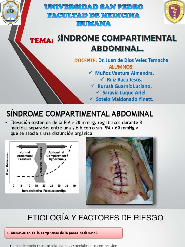 Sindrome Compartimental Abdominal Expo | PDF | Abdomen | Septicemia