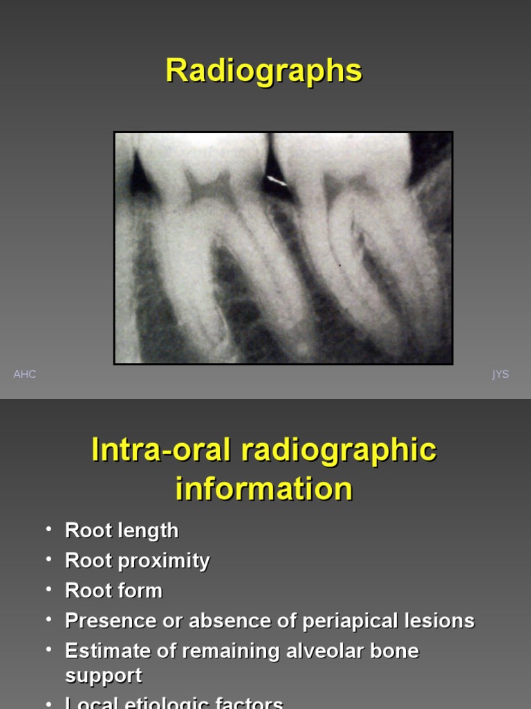 04 Radiographs | PDF | Dental Anatomy | Mouth
