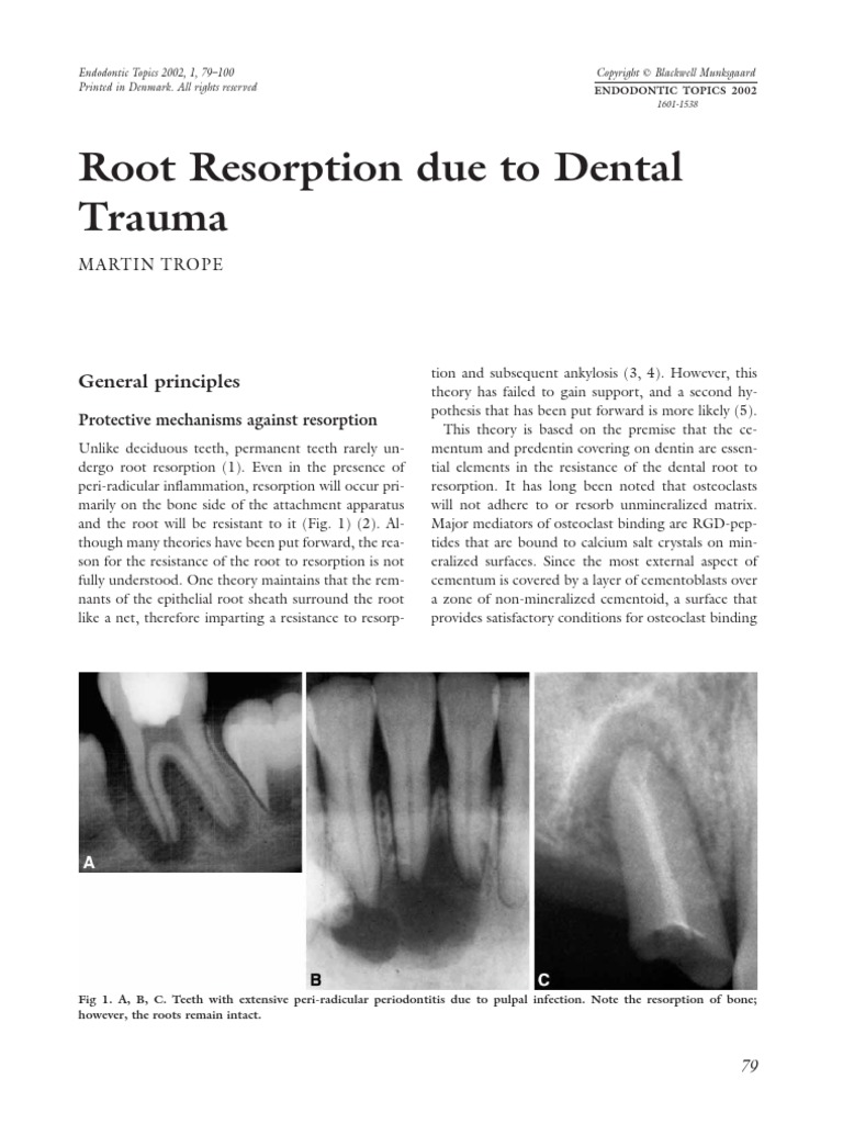 Root Resorption Due To Dental Trauma: General Principles | PDF | Human ...