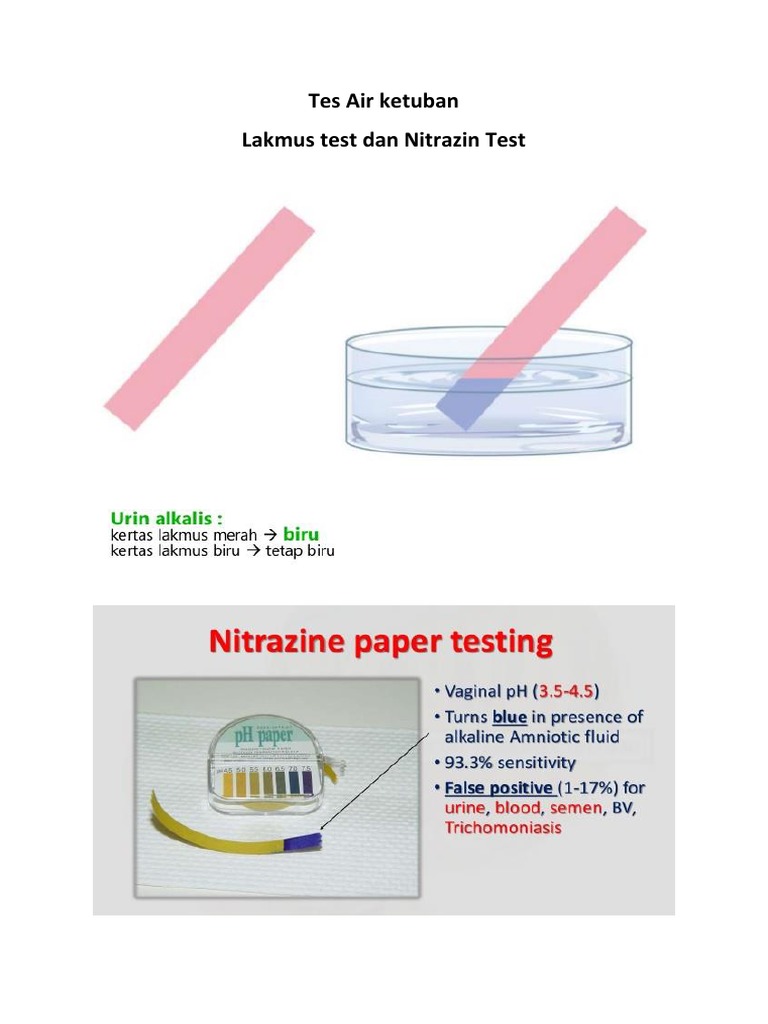 Tes Air Ketuban | PDF