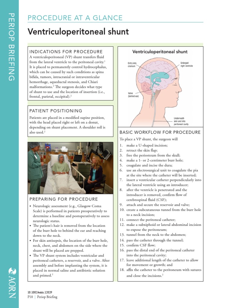 Ventriculoperitoneal Shunt: Procedure at A Glance | PDF | Medical ...