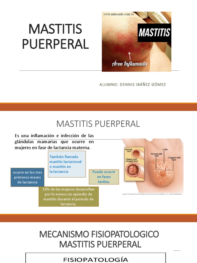 Mastitis Puerperal | PDF | Amamantamiento | Epidemiología