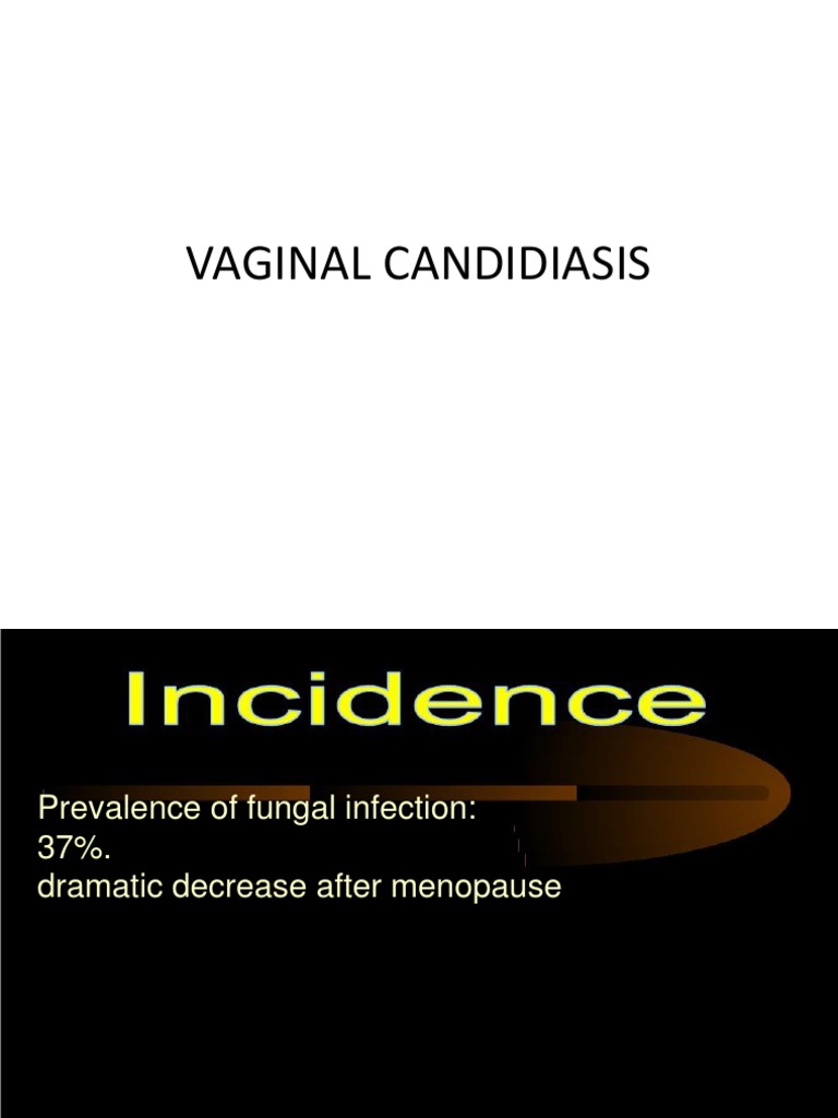 Vaginal Candidiasis Overview | PDF | Candidiasis | Candida (Fungus)