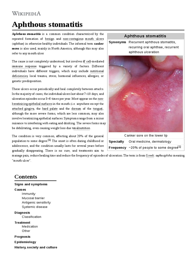 Aphthous Stomatitis | PDF | Immunology | Diseases And Disorders