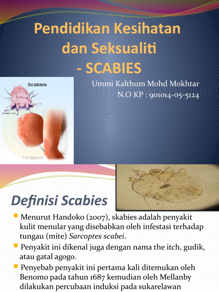 Presentation Scabies | PDF