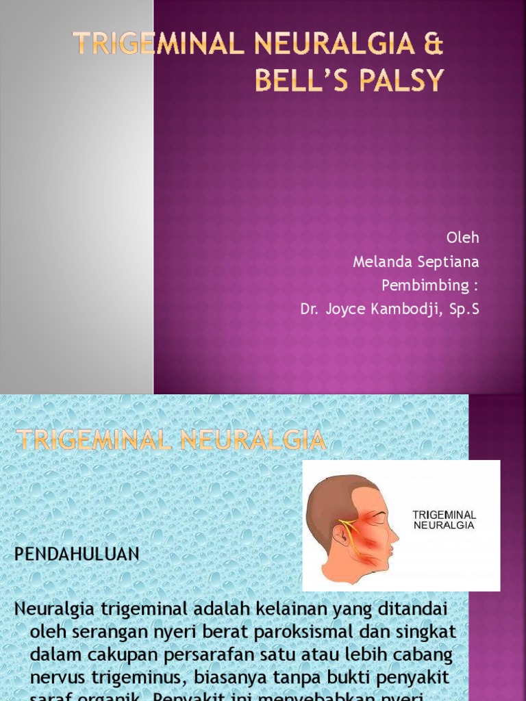 Trigeminal Neuralgia & Bell's Palsy | PDF