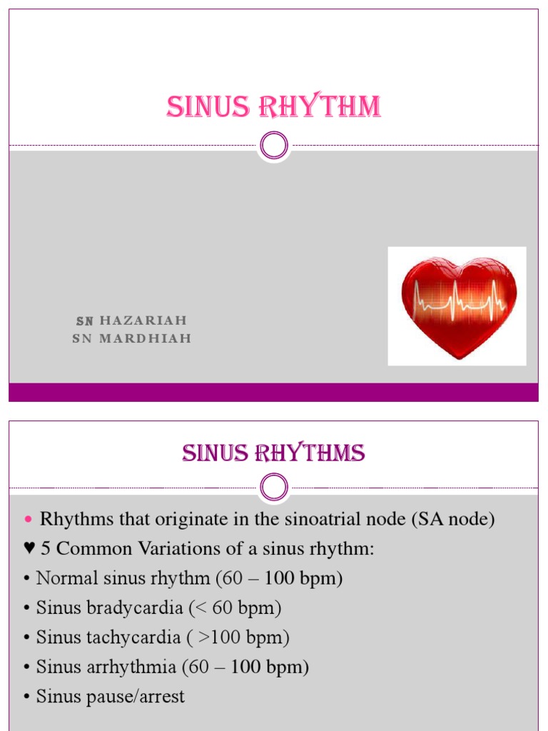 Sinus Rhythm | PDF
