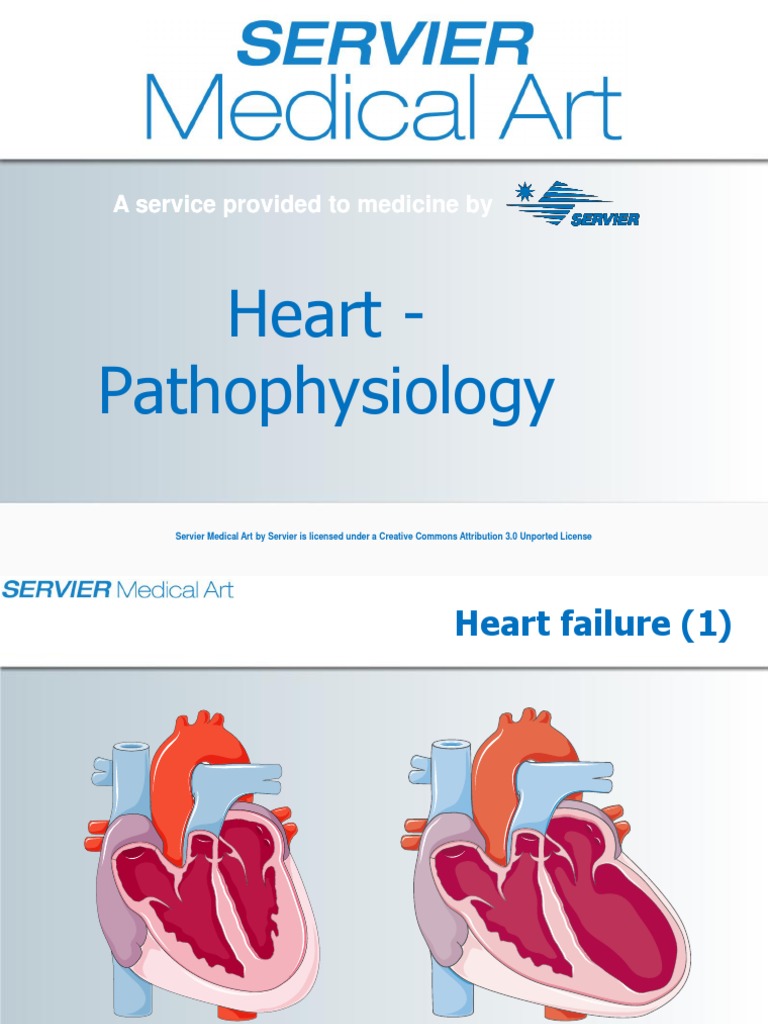 Heart Disease Pathophysiology Overview | PDF | Ventricle (Heart) | Heart