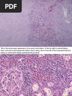 Types of Necrosis and Infarct | PDF | Necrosis | Ischemia