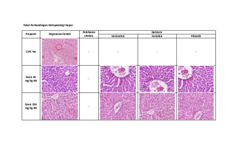 Tabel Perbandingan Histopatologi Hepar | PDF