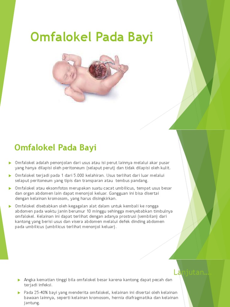 Omfalokel Pada Bayi | PDF
