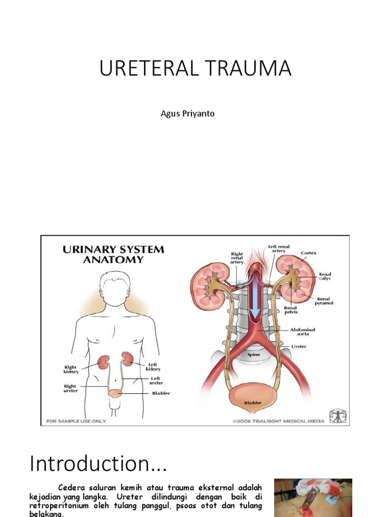 Ureteral Trauma PDF