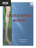 Resumo Varizes CEAP Corrigido | PDF