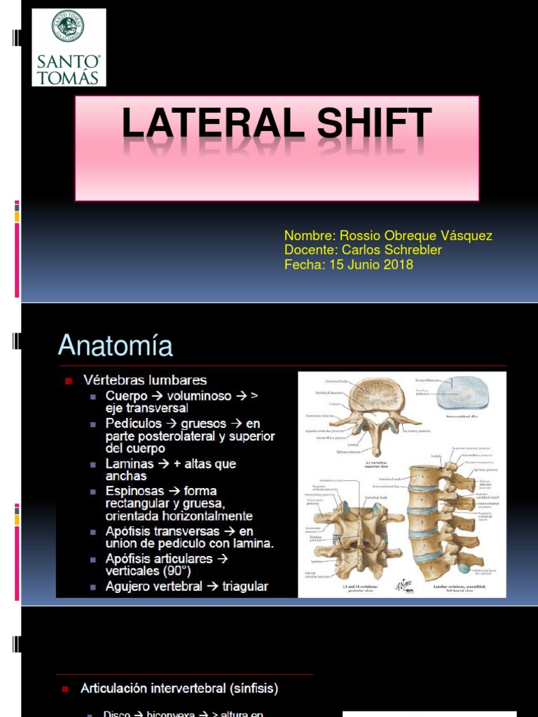 Tratamiento del Lateral Shift Lumbar | PDF | Vértebra | Sistema ...