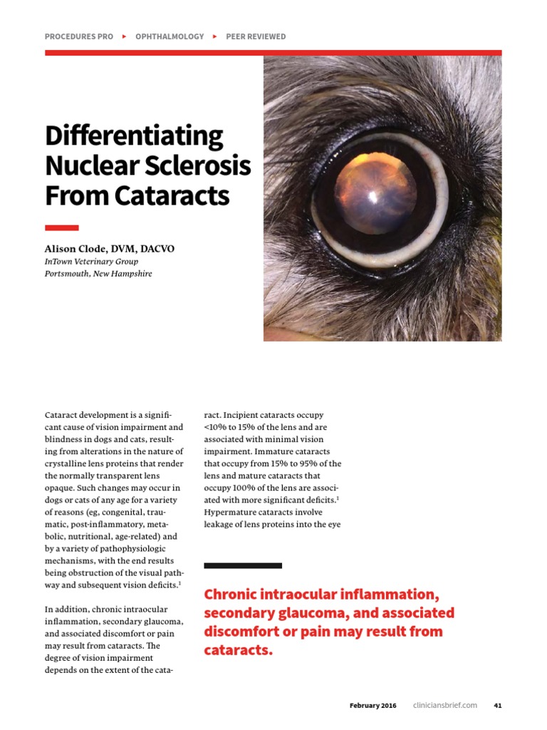 ProP - Differentiating Nuclear Sclerosis From Cataracts | PDF ...
