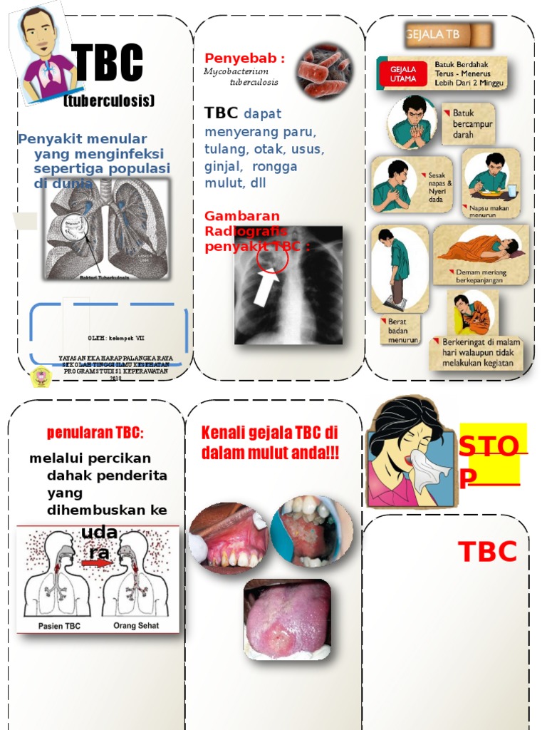 Leaflet TB | PDF