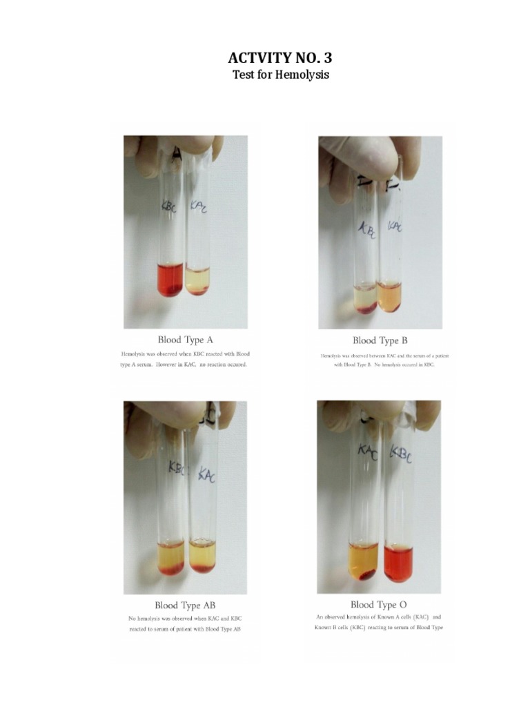 Blood Bank Lab | PDF | Science & Mathematics