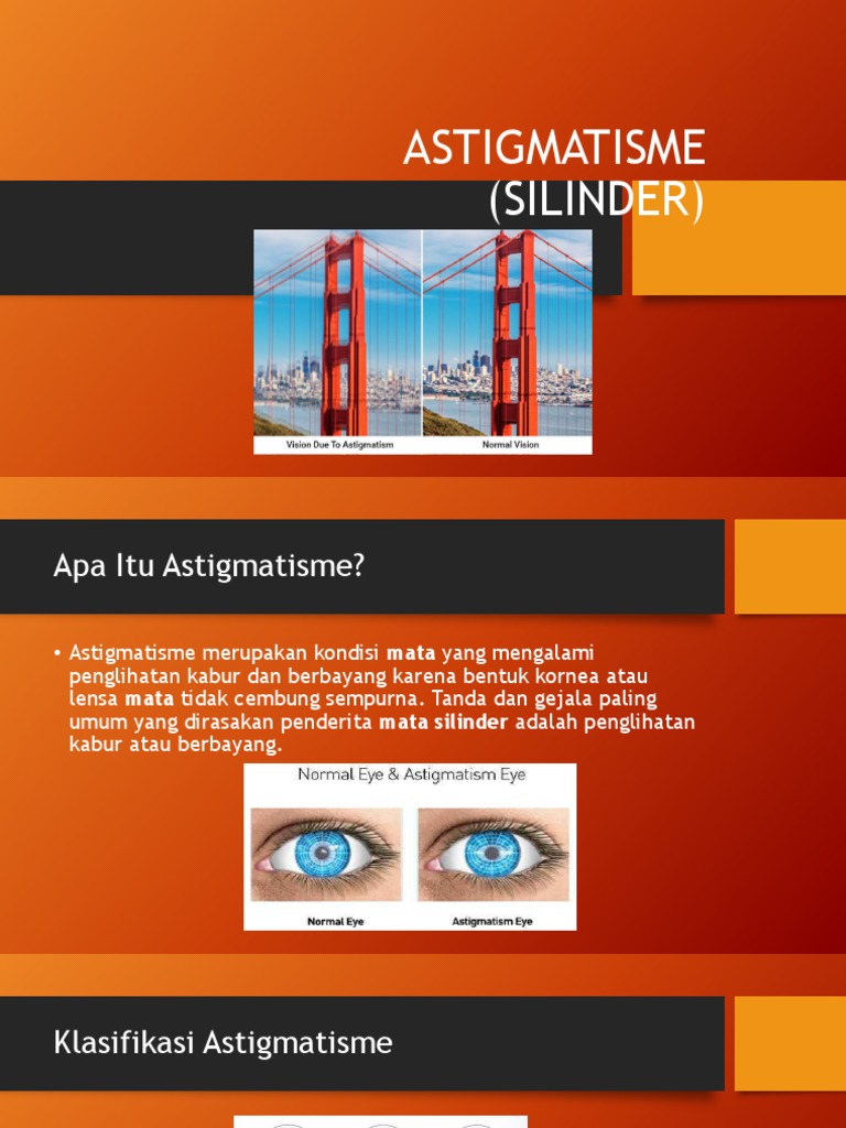 Astigmatism A | PDF
