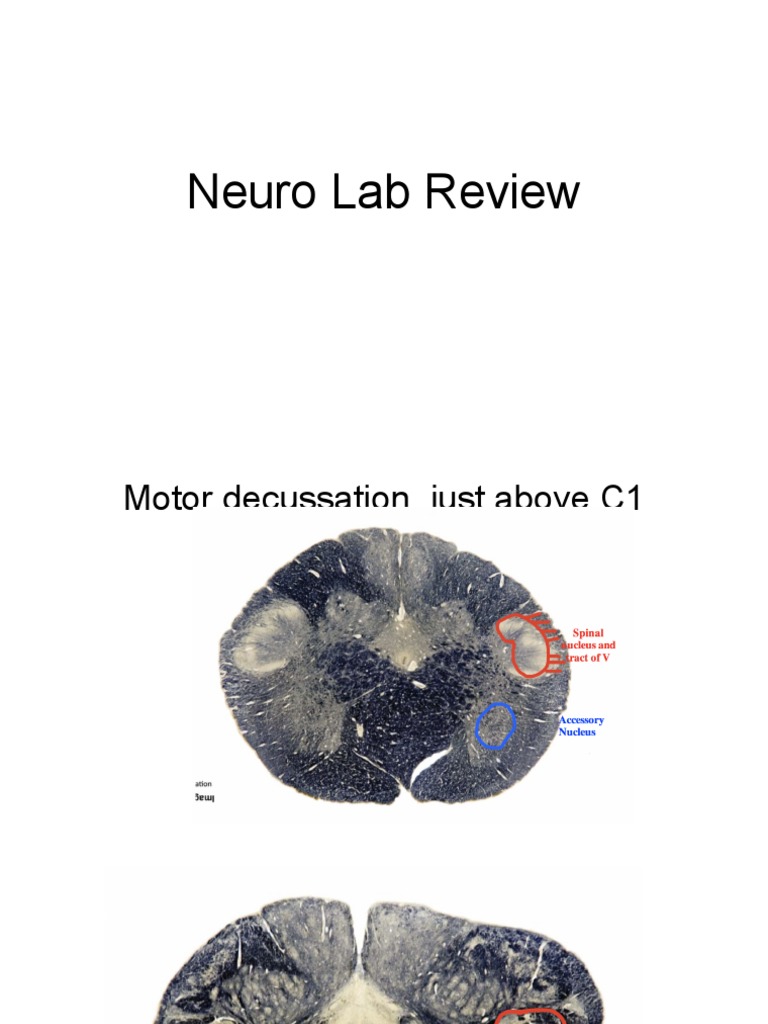 Neuro Lab Review: Motor Decussation C1 | PDF | Neuroanatomy | Science