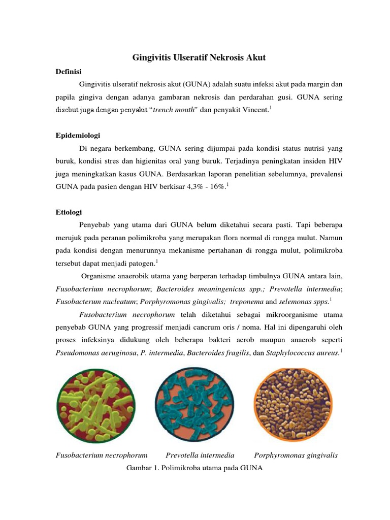 Acute Necrotizing Ulcerative Gingivitis | PDF