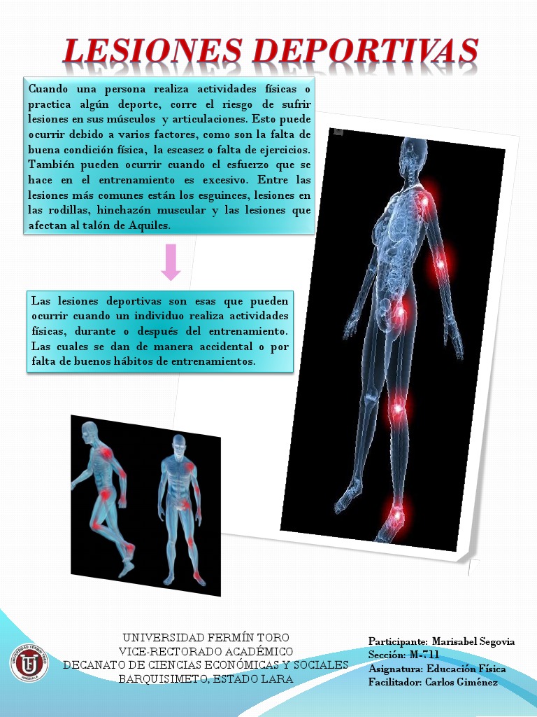 Infografía Sobre Las Lesiones Deportivas. | PDF | Rodilla | Edema