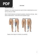 Understanding PPAM Aid for Amputees | PDF | Amputation | Prosthesis