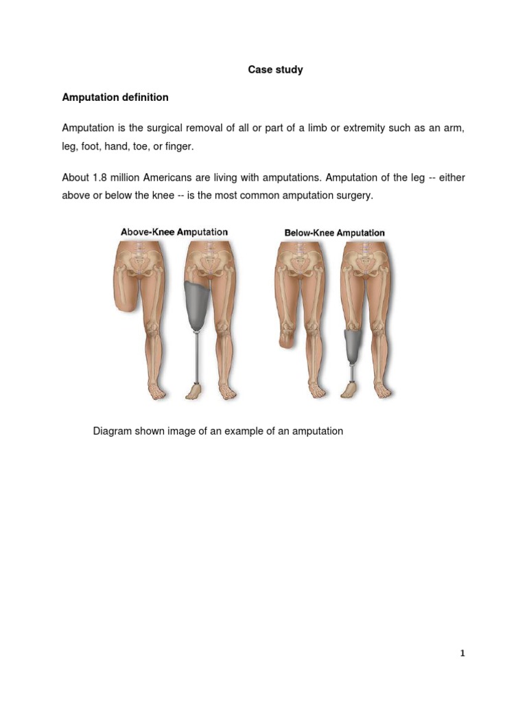 Amputation | PDF | Amputation | Prosthesis