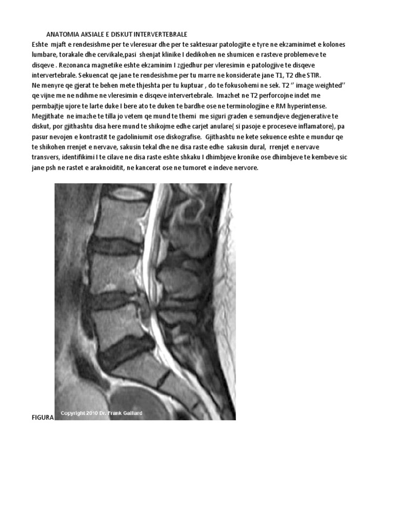 Anatomia Aksiale e Diskut Intervertebrale | PDF