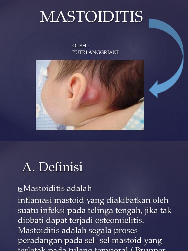 MASTOIDITIS: PENGOBATAN, KOMPLIKASI, DAN DIAGNOSA KEPERAWATAN | PDF