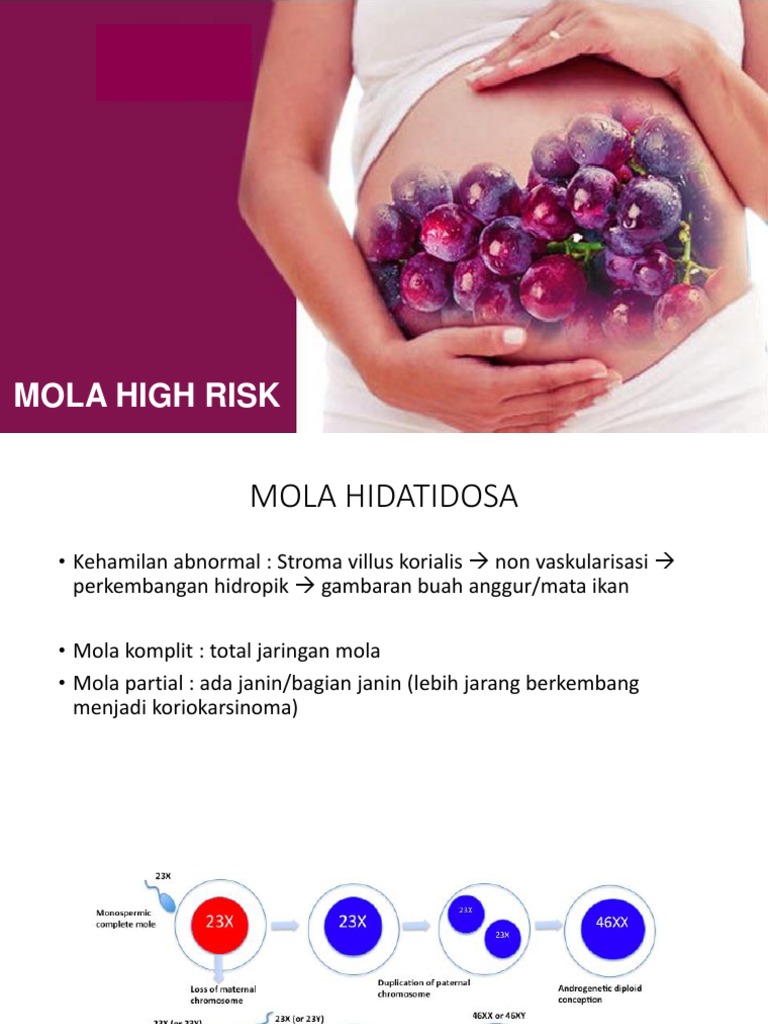 Kultum Mola Hidatidosa & Mola High Risk | PDF