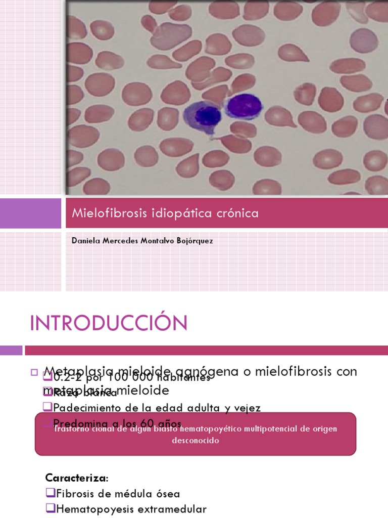 Mielofibrosis Idiopatica Cronica Daniela Montalvo | PDF | Hematopoyesis ...