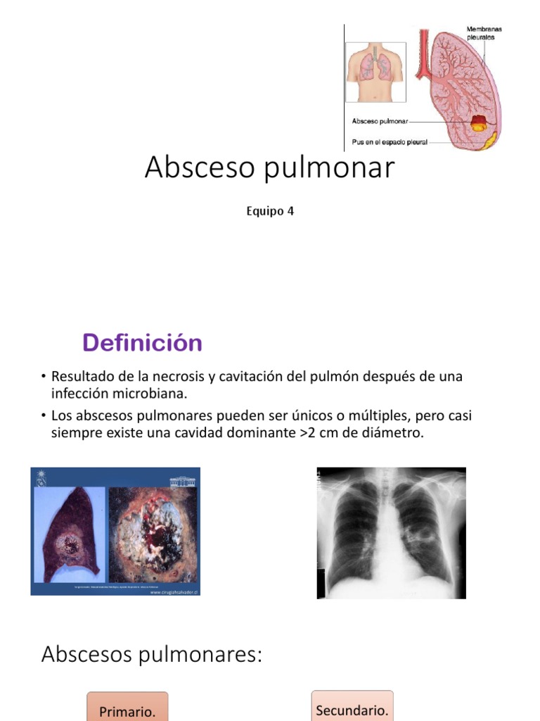 Absceso Pulmonar | PDF | Enfermedades y trastornos | Especialidades Medicas