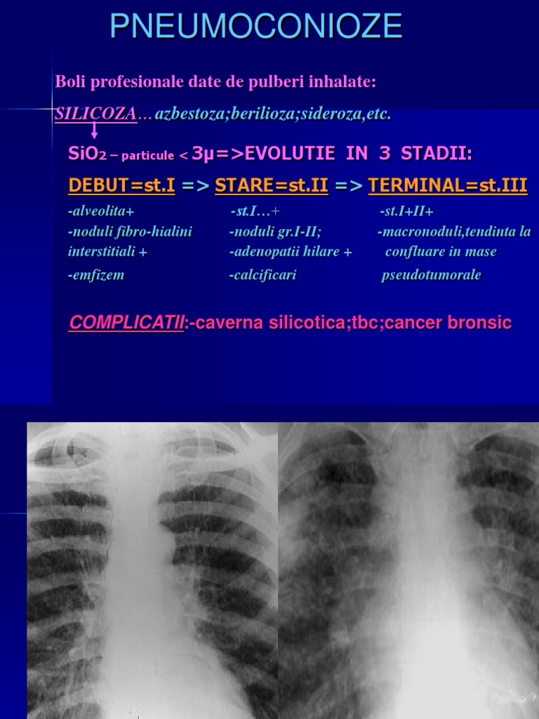 Pneumoconioze: Boli Profesionale Date de Pulberi Inhalate | PDF | Thorax (Human Anatomy ...