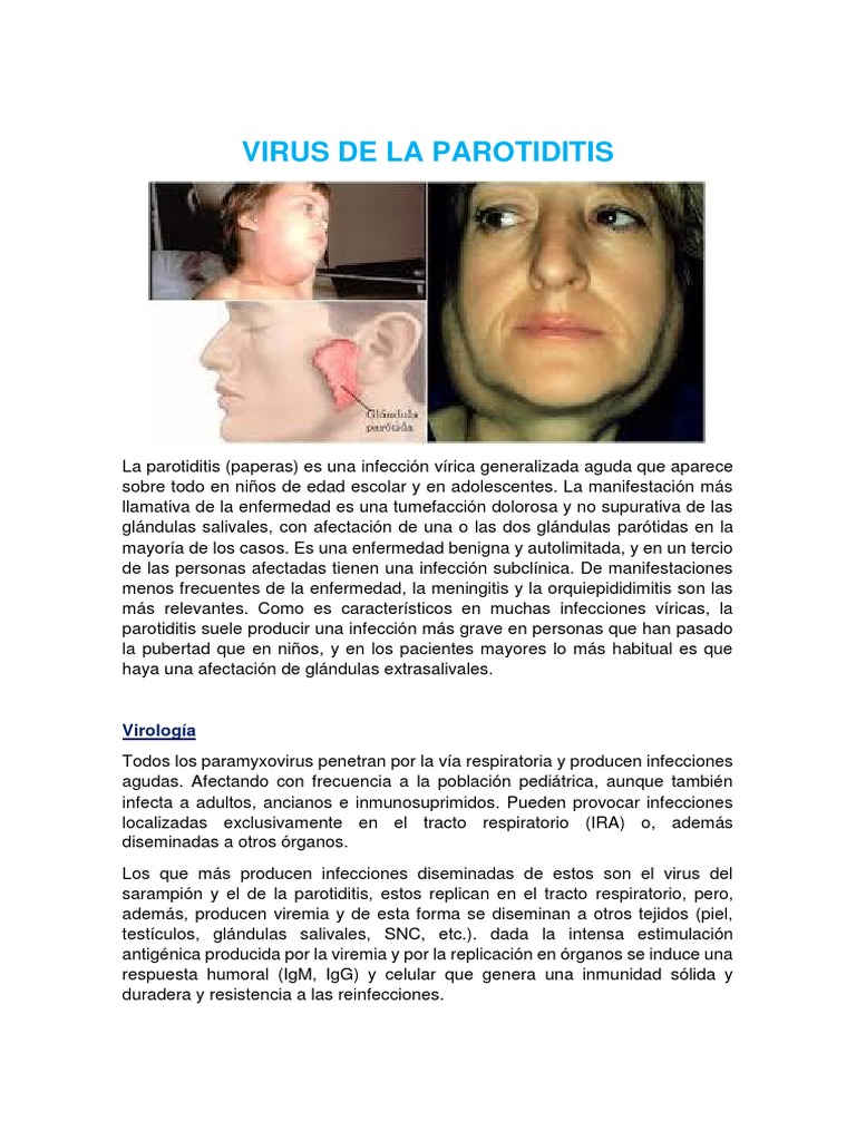 Parotiditis en Adultos: Síntomas y Tratamiento | PDF | Sarampión ...