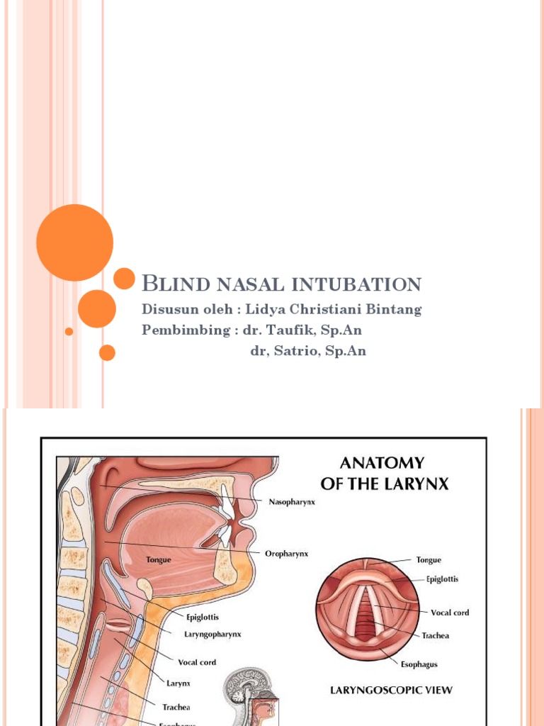 Blind Nasal Intubation | PDF