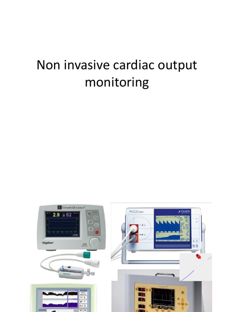 Non-Invasive Cardiac Output Monitoring | PDF | Angiology | Medical ...