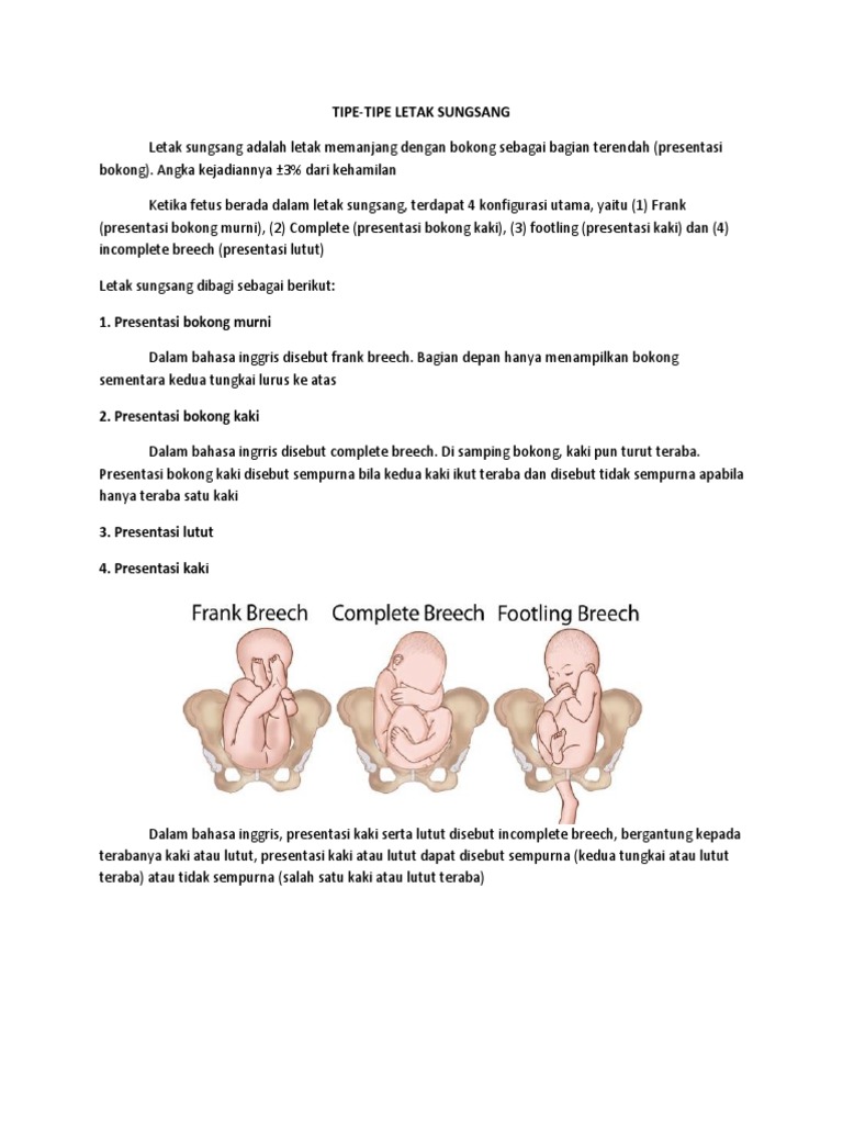 TYPES OF BREECH PRESENTATION | PDF