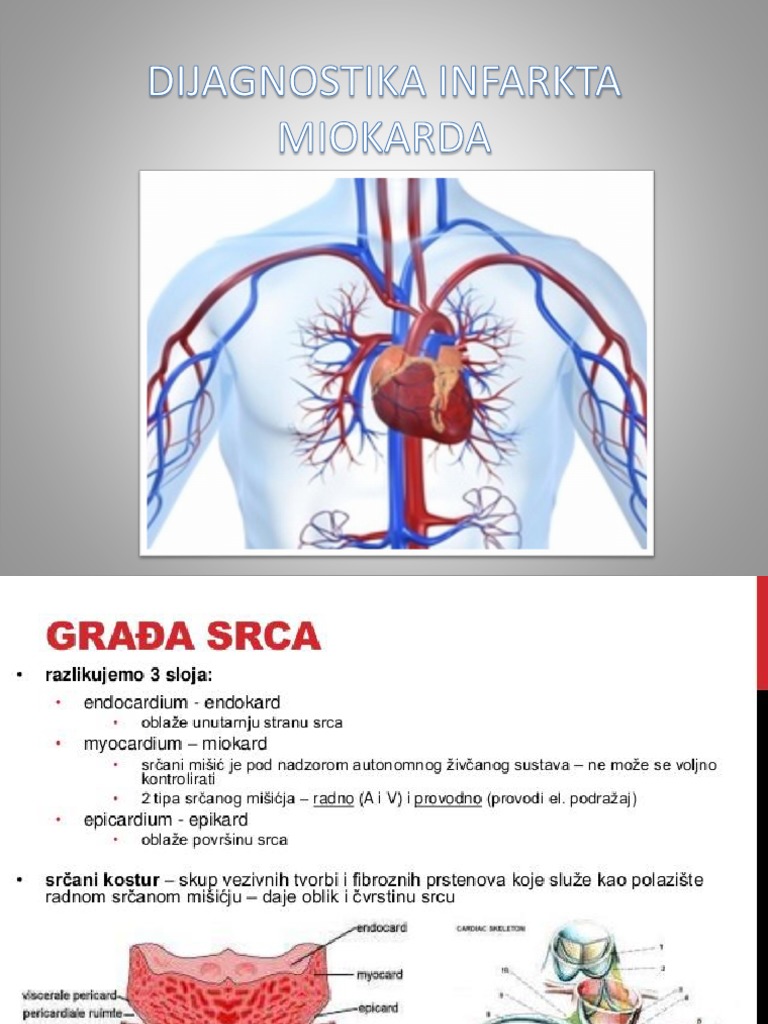 Dijagnostika Infarkta Miokarda | PDF