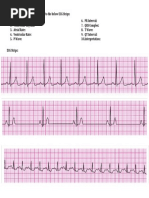 Basic EKG Interpretation Exam Answers | PDF | Electrocardiography ...