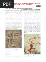 Modified Radical Neck Dissection Steps | PDF | Common Carotid Artery | Neck
