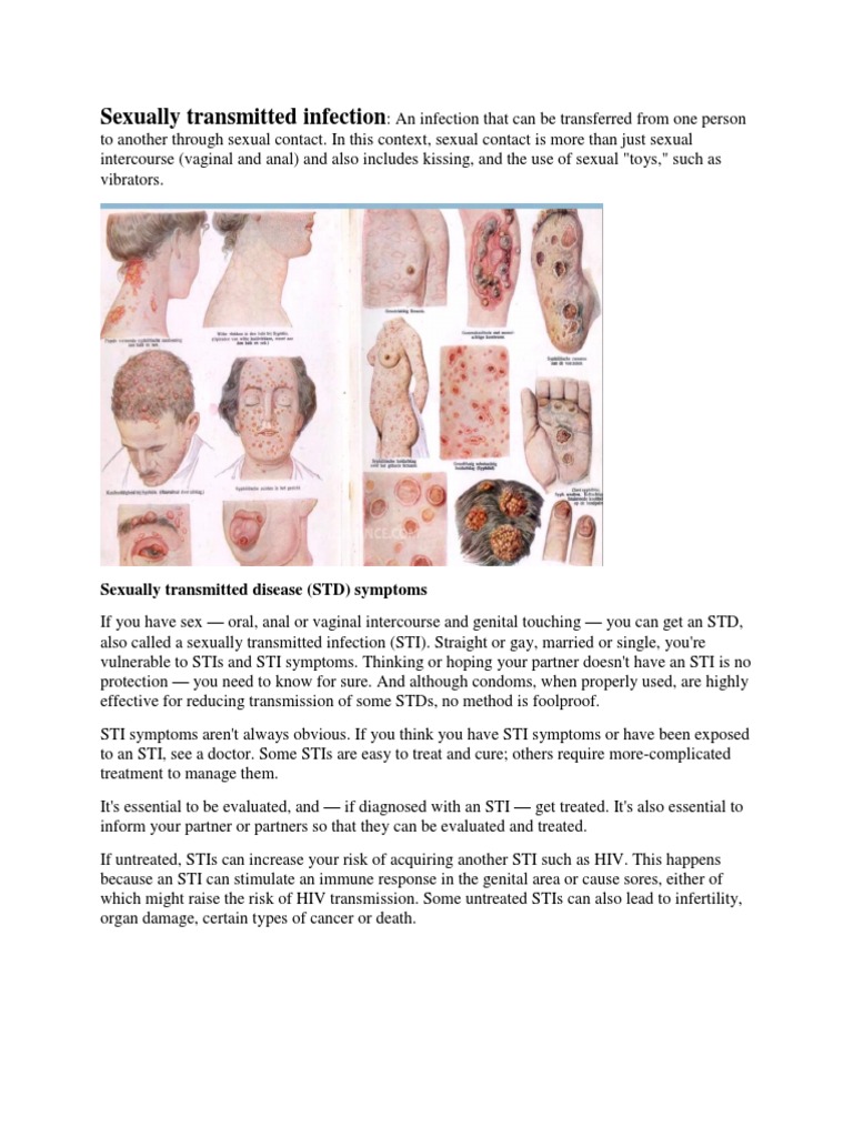 Sexually Transmitted Disease or STI Complete Symtoms | PDF | Sexually ...