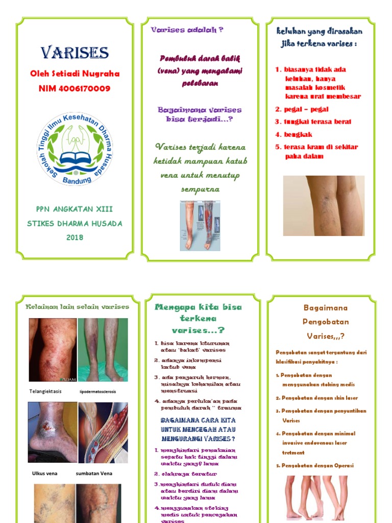 MENGURAI PENYAKIT VARISES | PDF