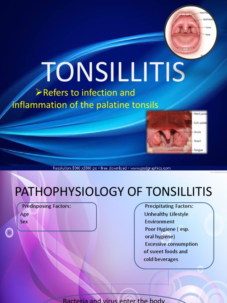 Tonsillitis: Refers To Infection and Inflammation of The Palatine Tonsils | PDF