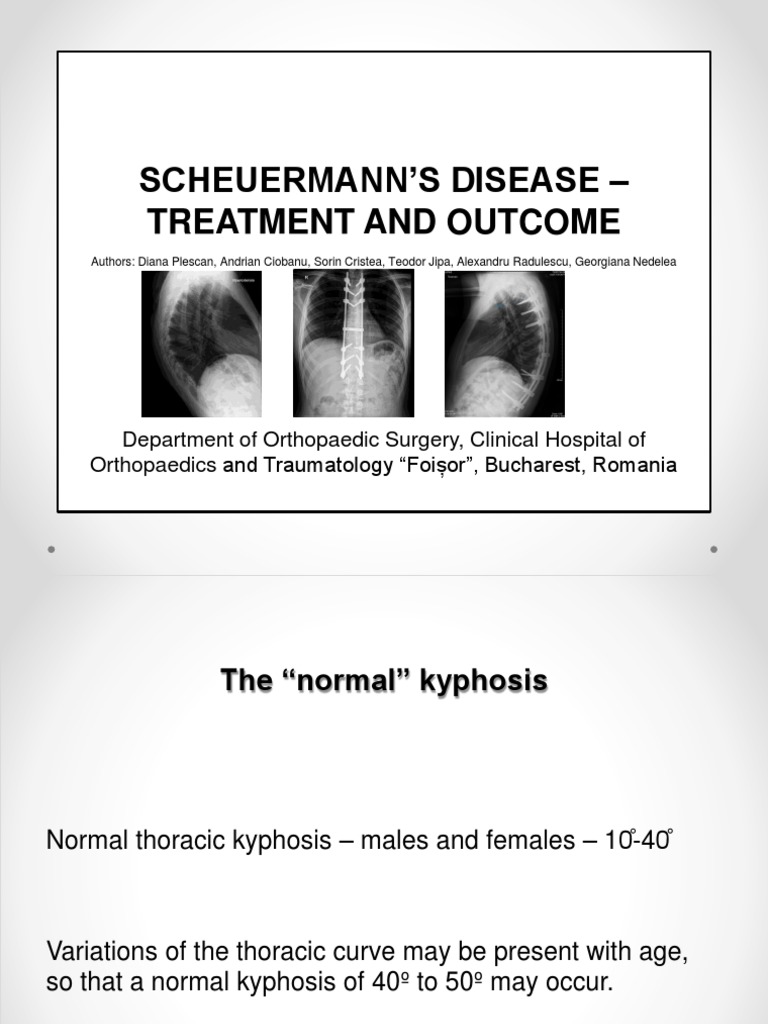 Scheuermann's Disease: Treatment Insights | PDF | Clinical Medicine ...