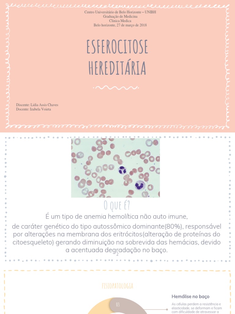 Esferocitose Hereditária | PDF | Anemia | Hemácia
