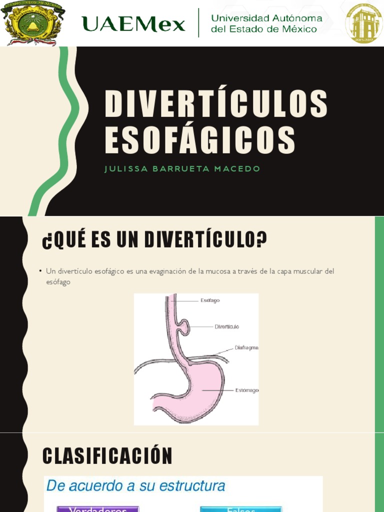 Divertículos Esofágicos | PDF | Medicina | Medicina CLINICA
