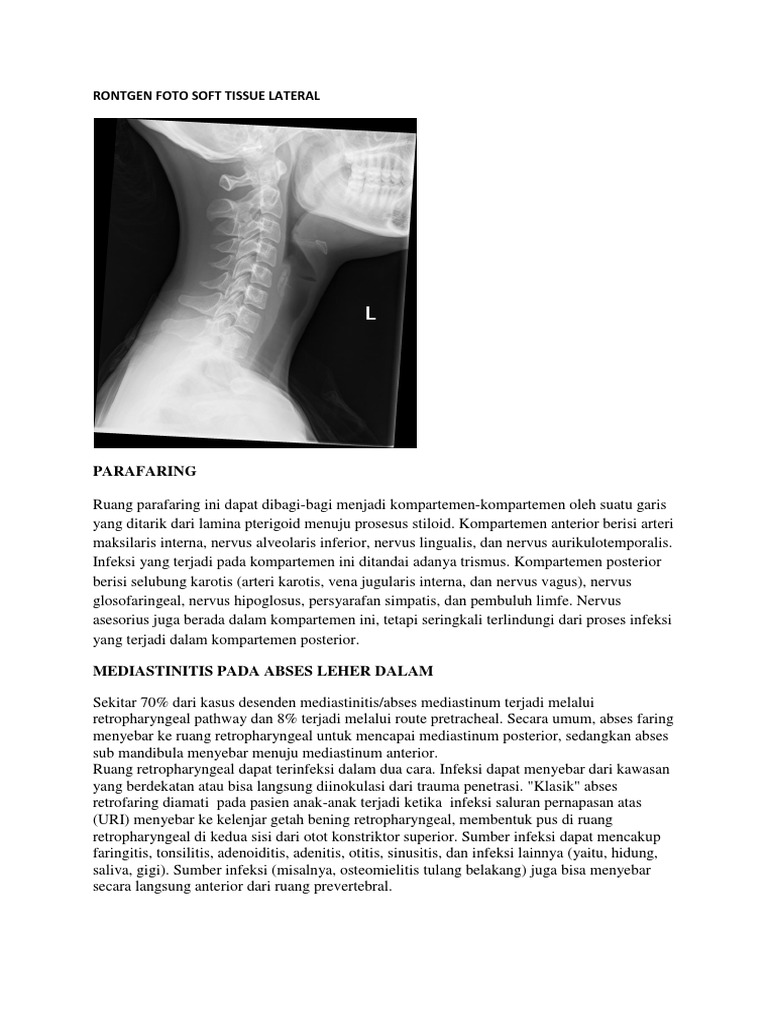 Rontgen Foto Soft Tissue Lateral: Parafaring | PDF