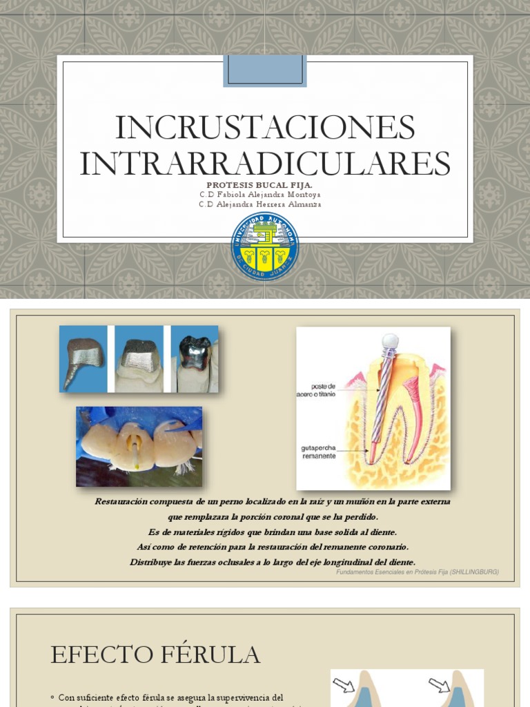 INCRUSTACIONES INTRARRADICULARES (Autoguardado) | PDF | Dentadura ...