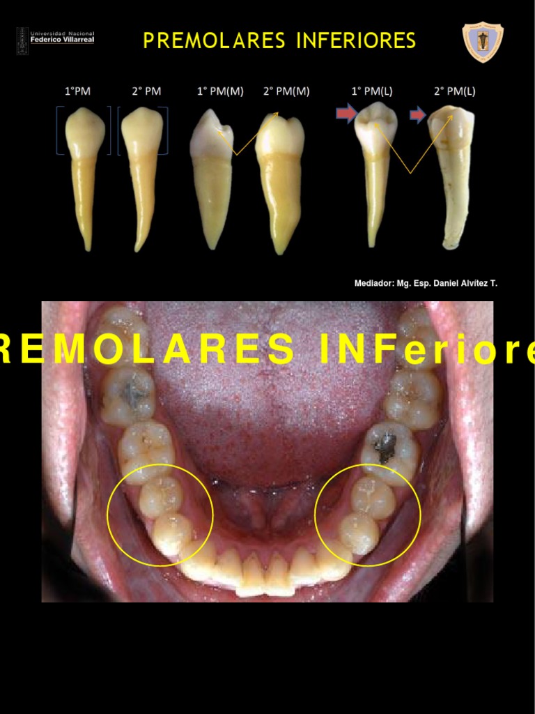 Premolares Inferiores | PDF