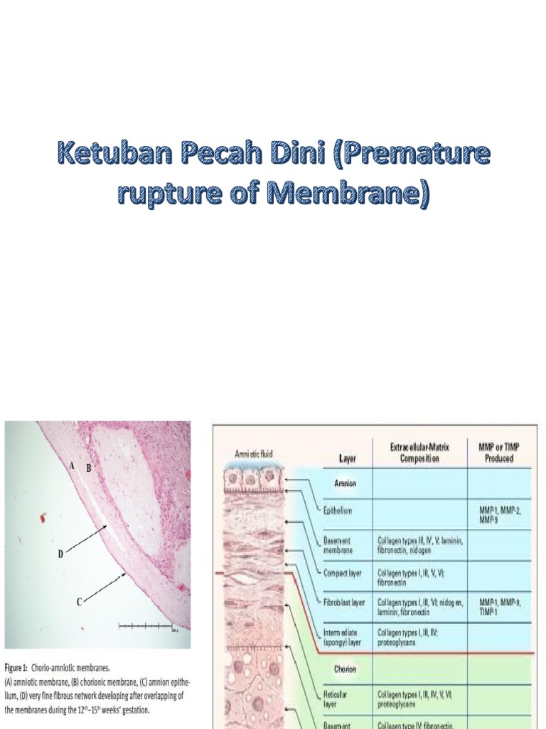 Anatomi, FR, Pathway PROM and PPROM | PDF